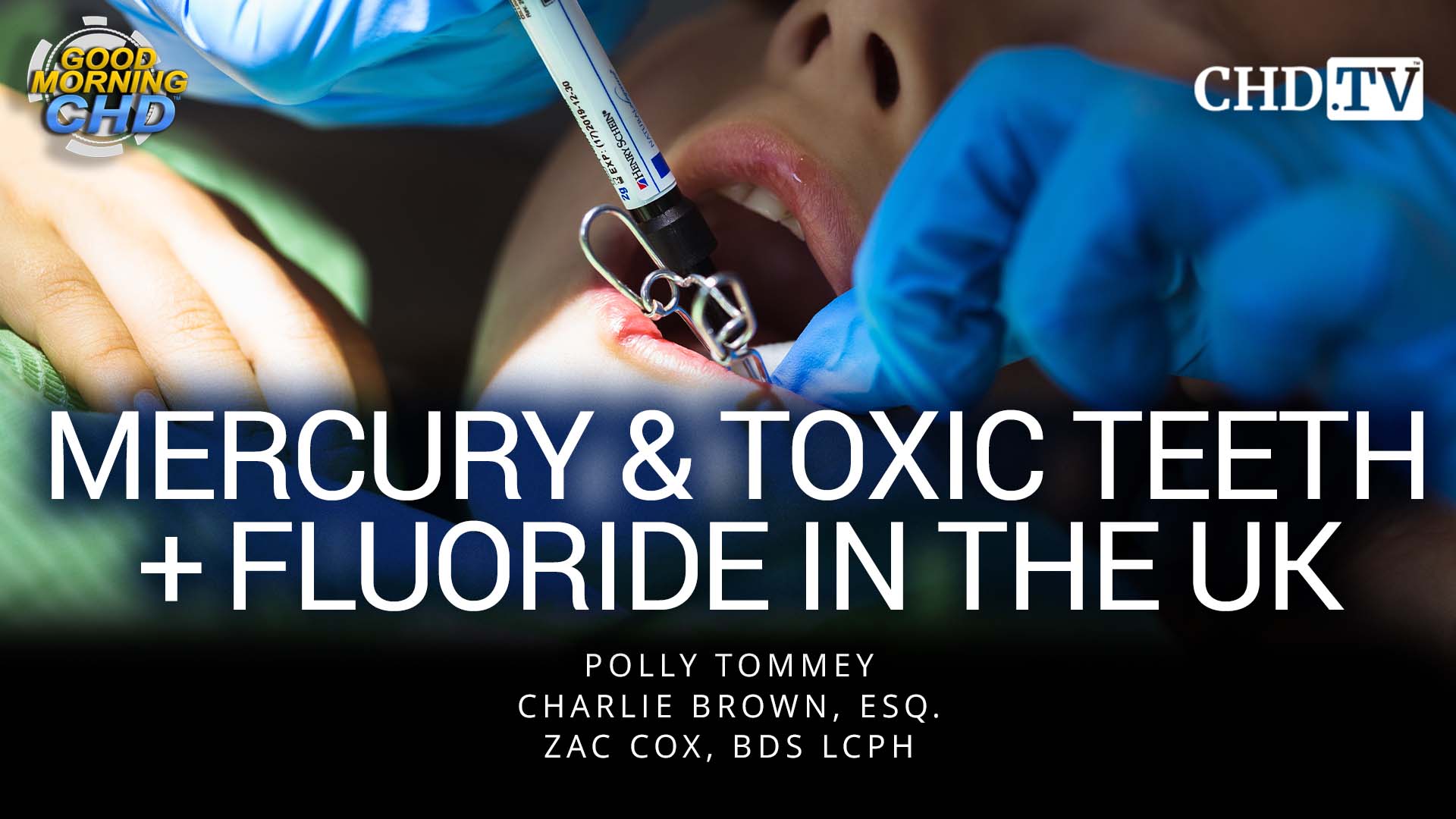 Mercury & Toxic Teeth + Fluoride in the UK | Childrens Health Defense